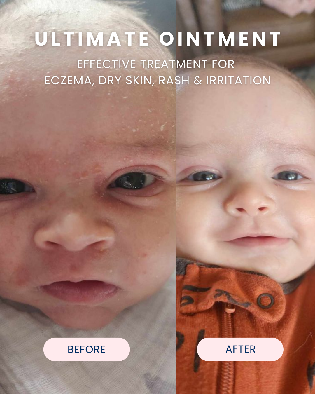 Personal Care – Noodle & Boo